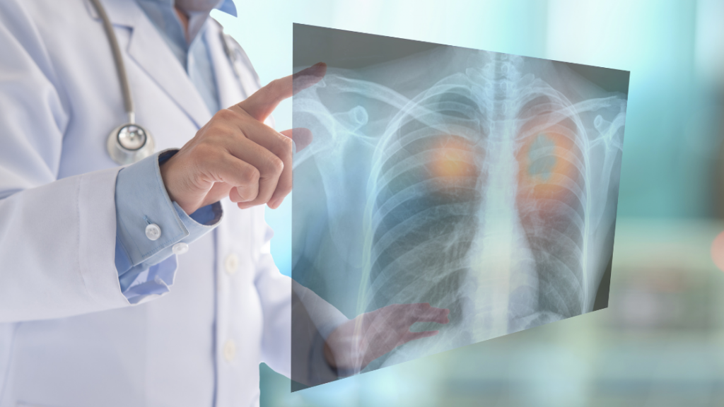 Exploring the Benefits of X-ray Imaging in Modern Medicine