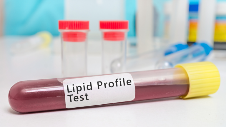Lipid Profile Test Singapore: Key Components Explained
