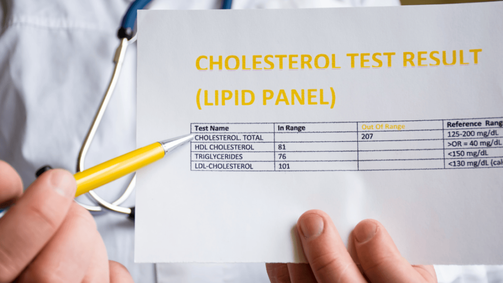 Lipid Profile Test Singapore: What to Expect
